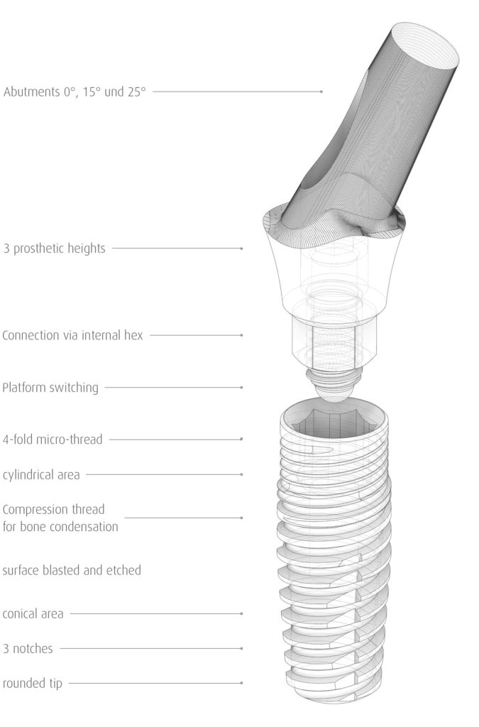 radix | Implants & Biomaterials - Bone Level Implantat